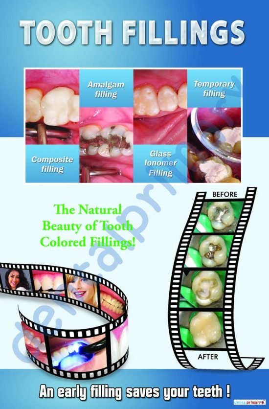 Dental Posters - Dental Primary