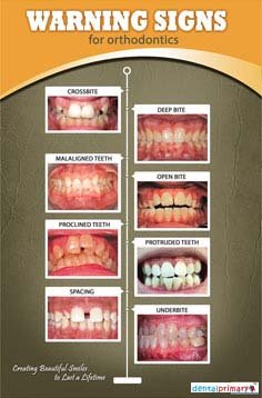 Dental Posters - Dental Primary